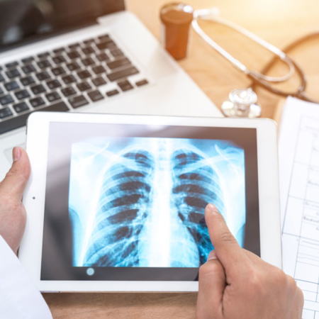 CT Lung Cancer Screening Program - Triad Radiology Associates