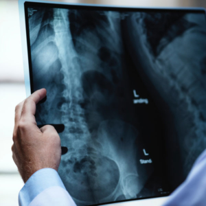 Pain Management Interventions - Triad Radiology Associates